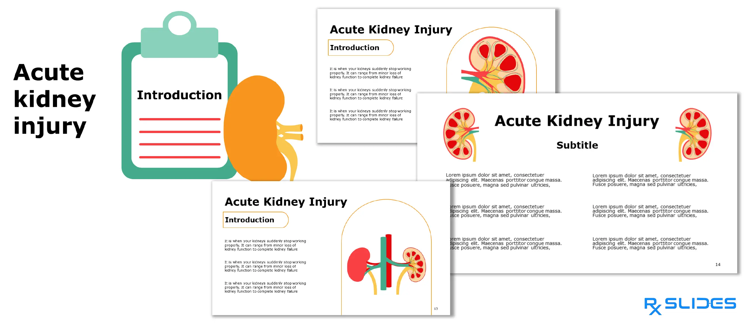 Acute kidney injury PowerPoint Template | RxSlides The largest online store for medical ...